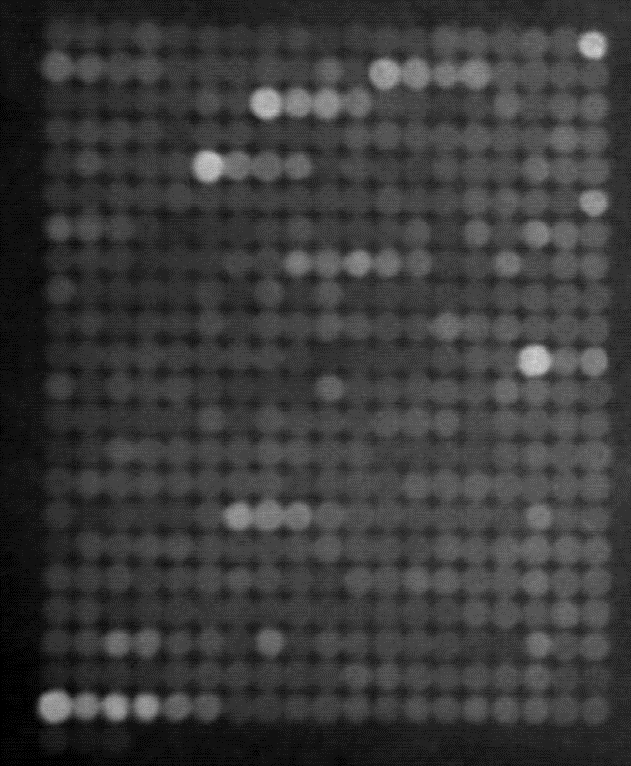 Protein microarray for mapping SARS-COV-2 (COVID-19) antibody