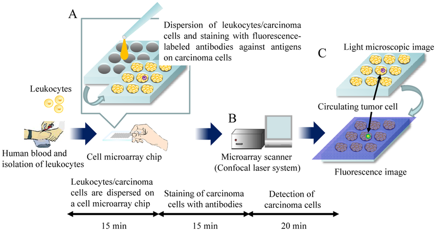 The Future of Cancer Diagnosis: Empowering Precision with Automated ...